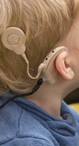 Cochlear Implants Assessments – Hearing Help